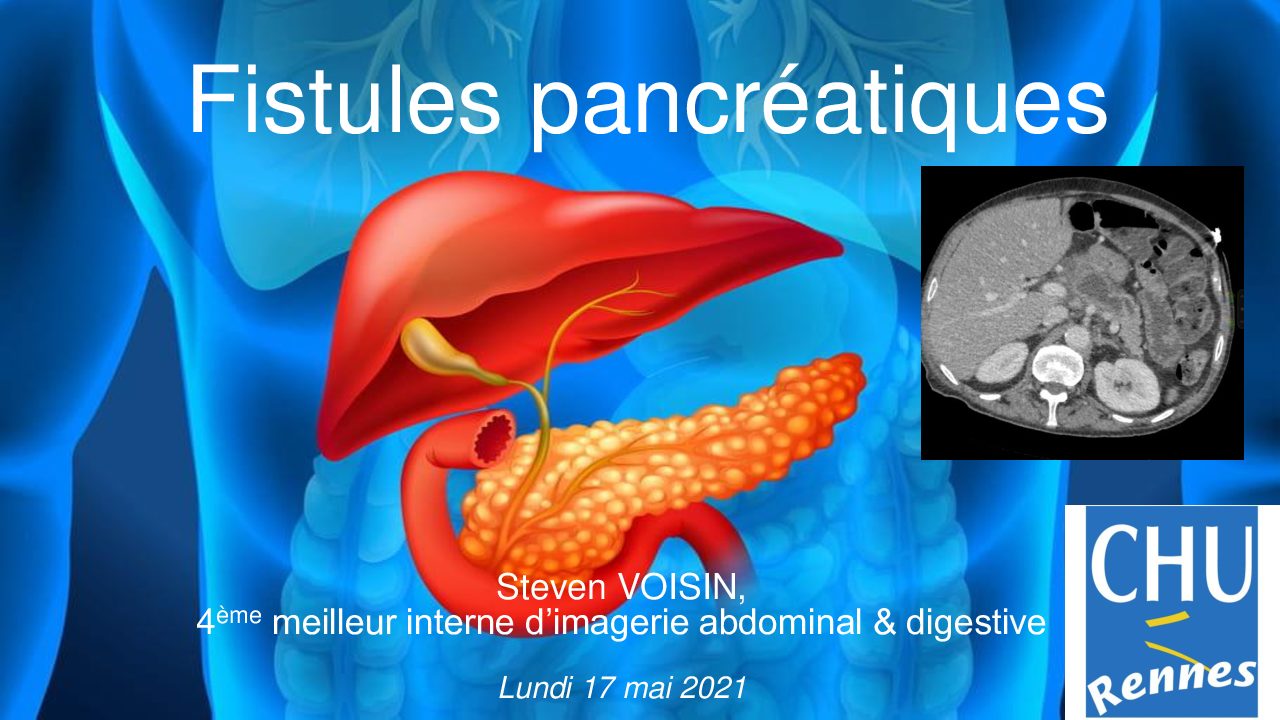 Index of /wp-content/uploads/2011/07